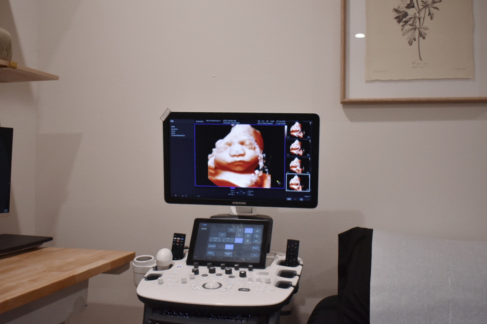 Nest Ultrasound Studio | Prenatal 3D/4D Ultrasound Trinity FL