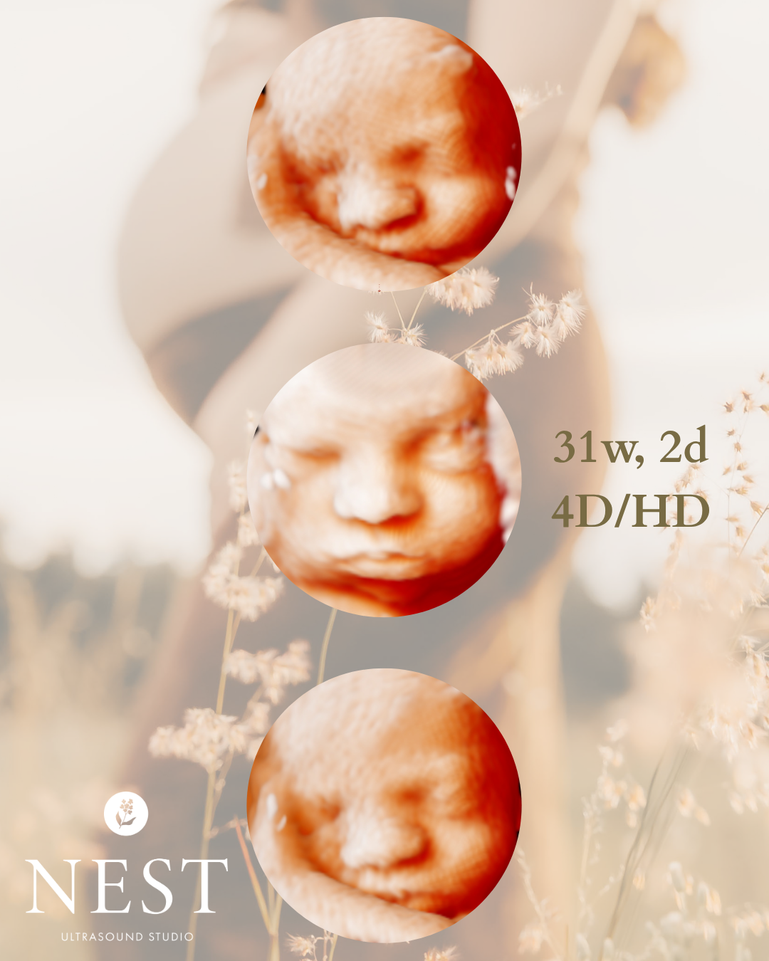 When Is the Best Time to Book Your 3D/4D/HD Ultrasound? | Nest ...